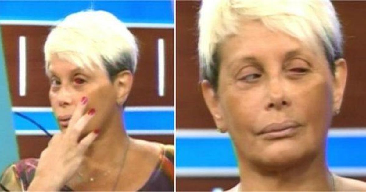 ¿Qué le pasó a Carmen Barbieri? Fue a la televisión con un ojo explotado