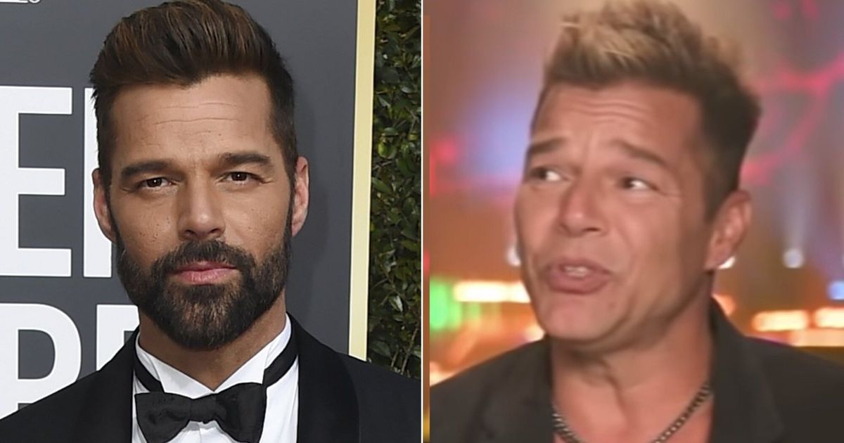La nueva cara de Ricky Martin se volvió tendencia y memes: ¿Qué se hizo?