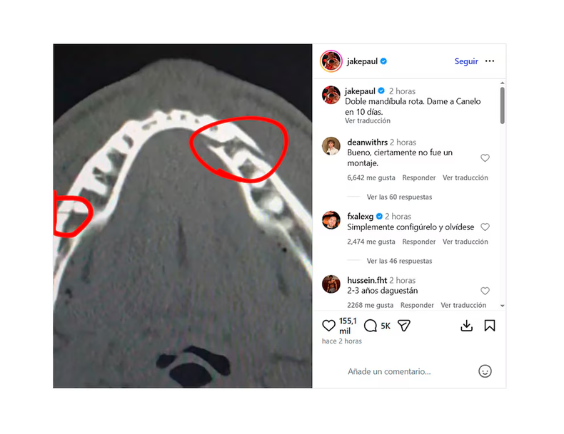 La impactante imagen que subió Jake Paul tras confesar que Anthony ...