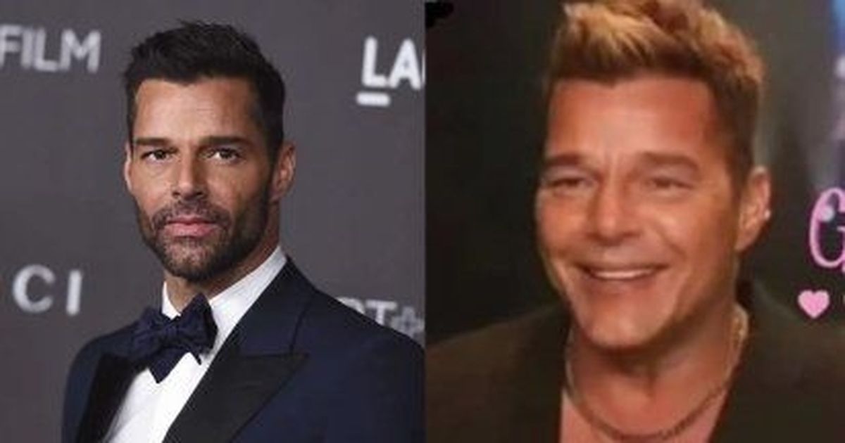 Ricky Martín dio la (nueva) cara y explicó qué le pasó en el rostro