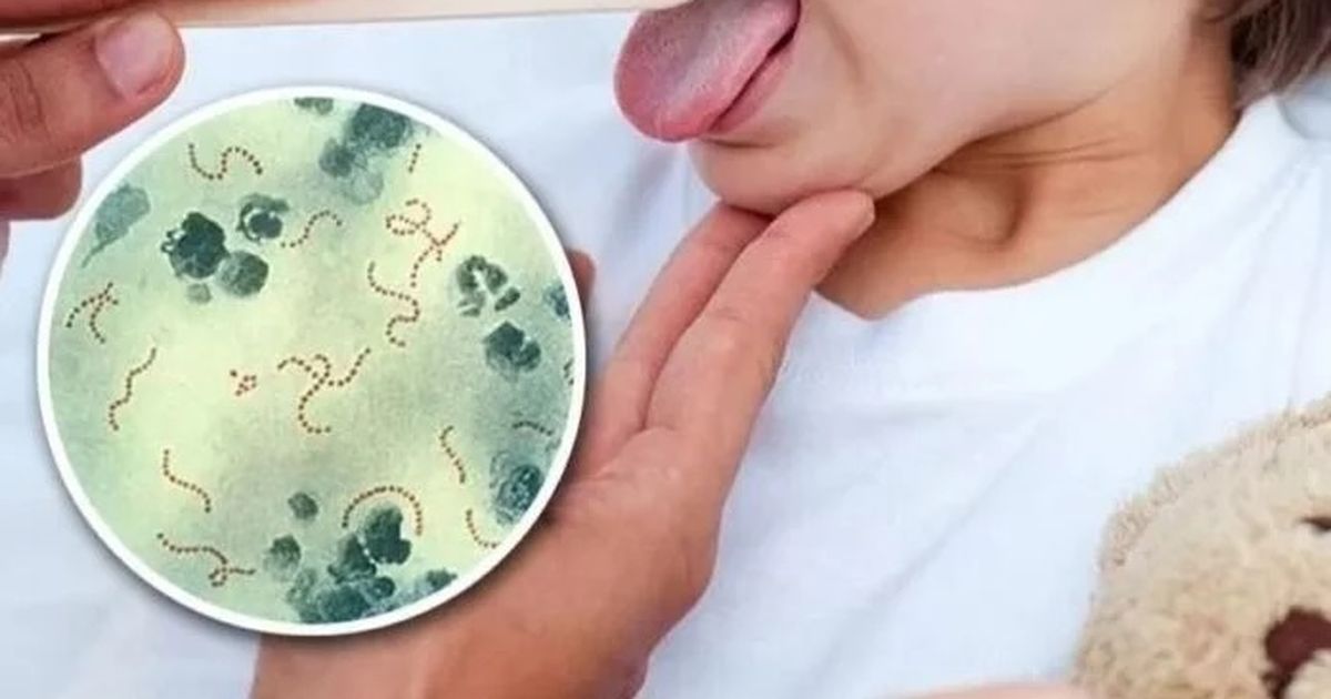 Streptococcus pyogenes: diez preguntas clave para entender la enfermedad