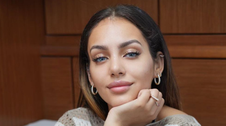 Una modelo brasilera se sometió a una cirugía de cambio de color de ...